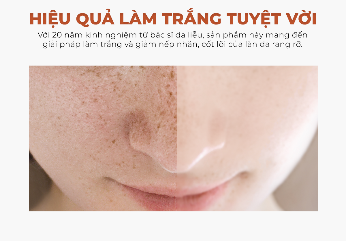 Bộ Đôi Hỗ Trợ Dưỡng Sáng Da, Giảm Mờ Đốm Nâu WonJin Effect Serum Melaless 50ml+ Kem Dưỡng ...