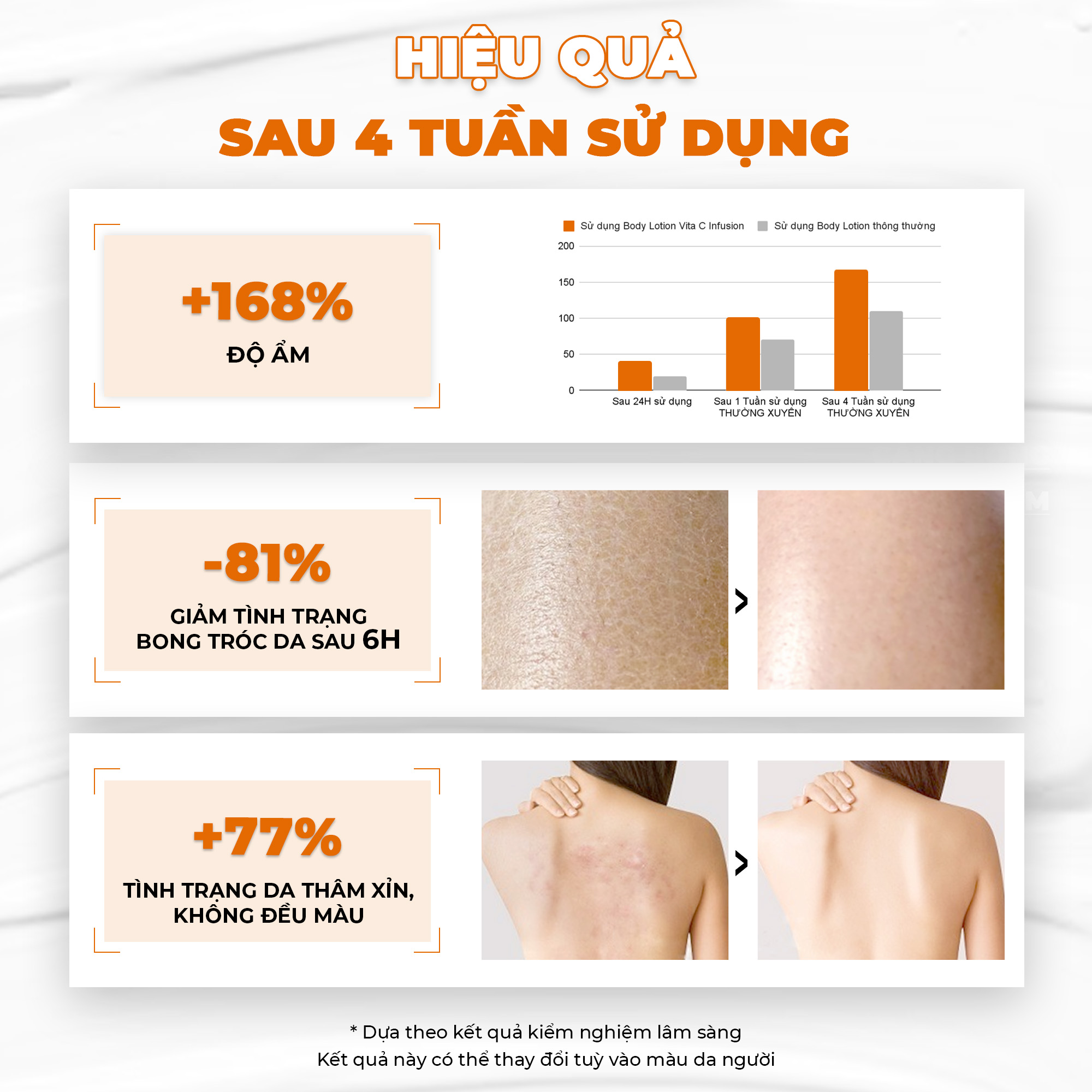 Kem Body Lotion Dưỡng Trắng & Chống Lão Hoá Mincer Pharma Vita C Infusion Body Lotion 250ml ...