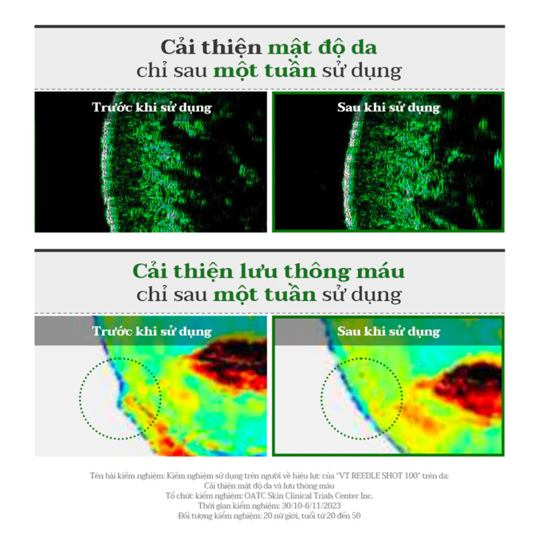 [KOL] - Tinh chất vi kim VT REEDLE SHOT 50/100/300/700 | Shopee Việt Nam