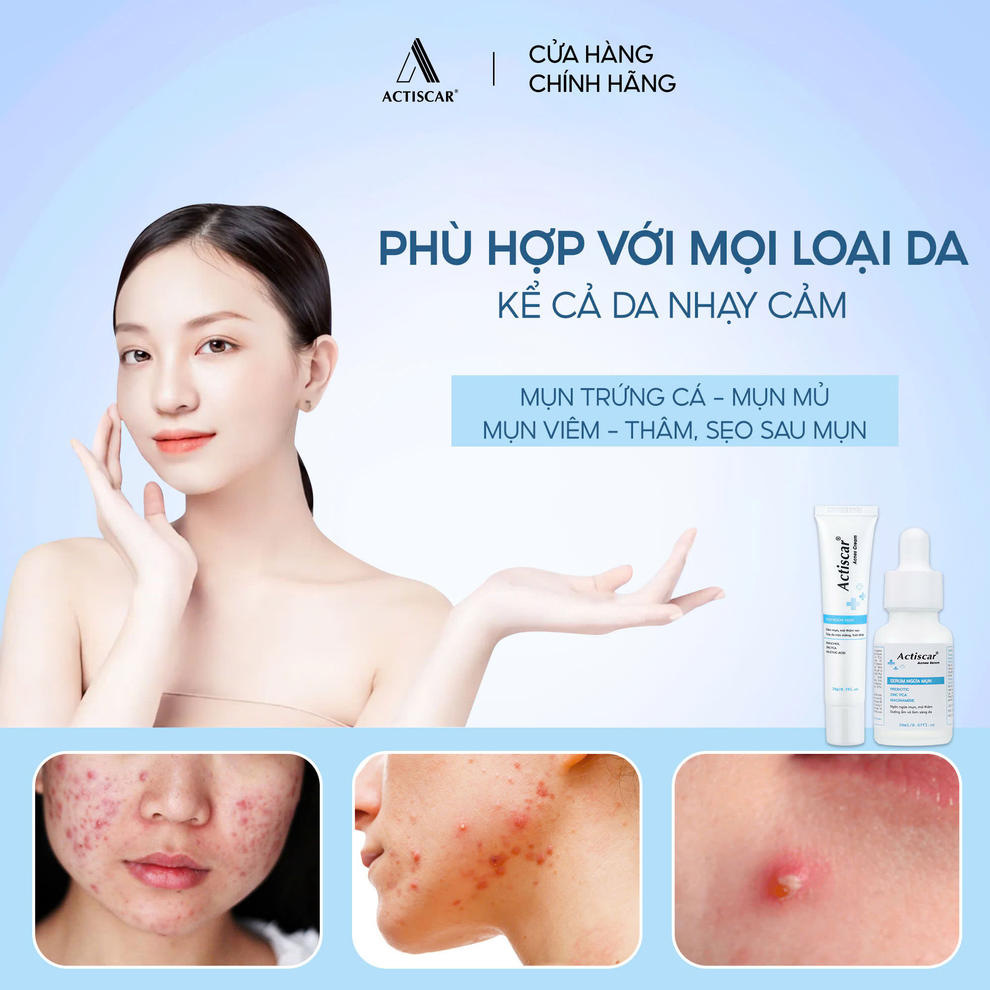 Kem Chấm Mụn, Serum Mụn, Miến Dán Mụn Actiscar Acnes, Giảm Mụn Sưng ...