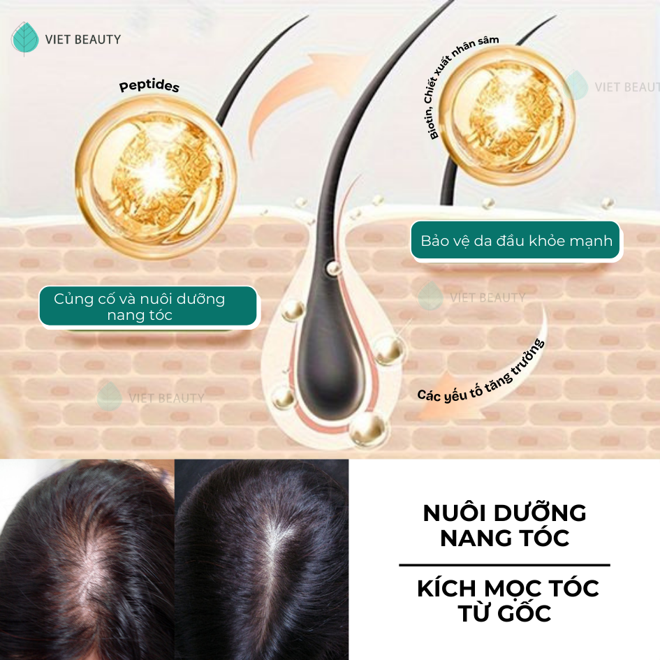 [HỎA TỐC HN]Tinh chất dưỡng nang tóc, tăng mật độ tóc Bio-Placental ...