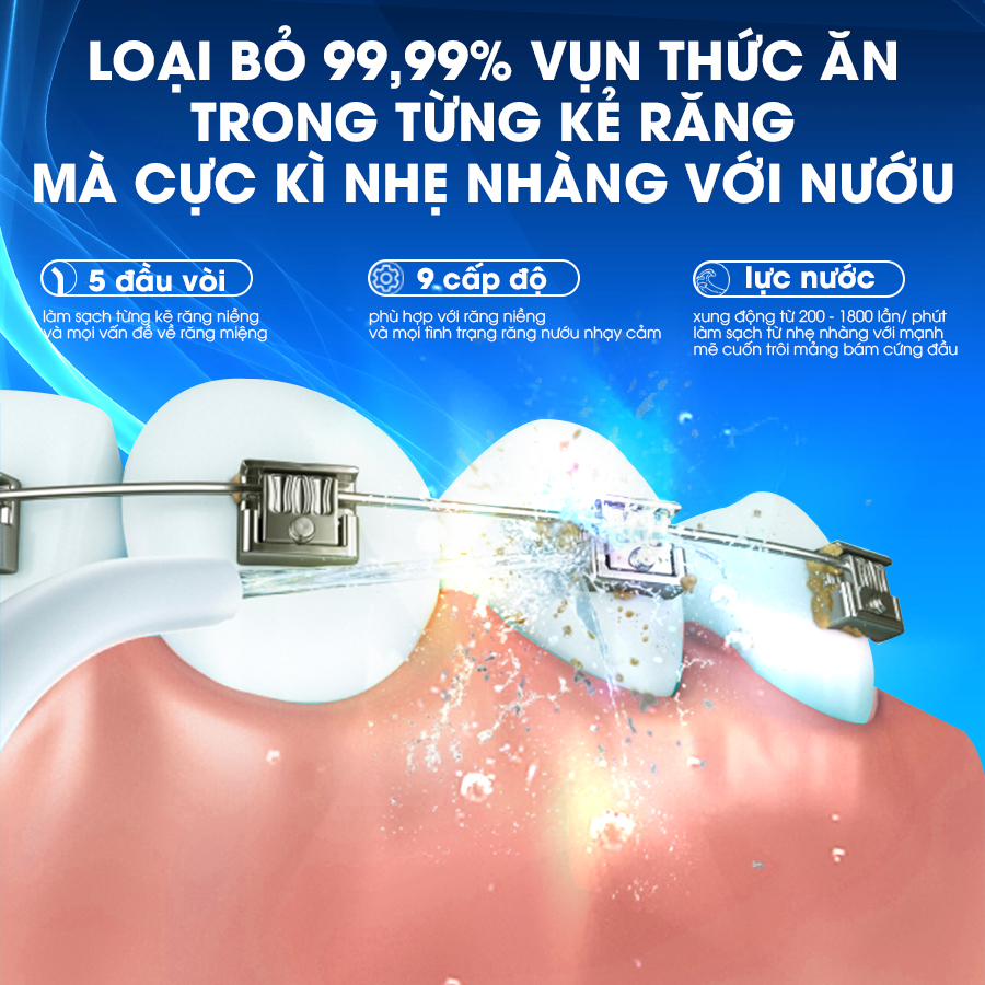 Máy tăm nước WaterBeam cho Người Niềng Răng, Chỉnh Nha được Nha sĩ ...