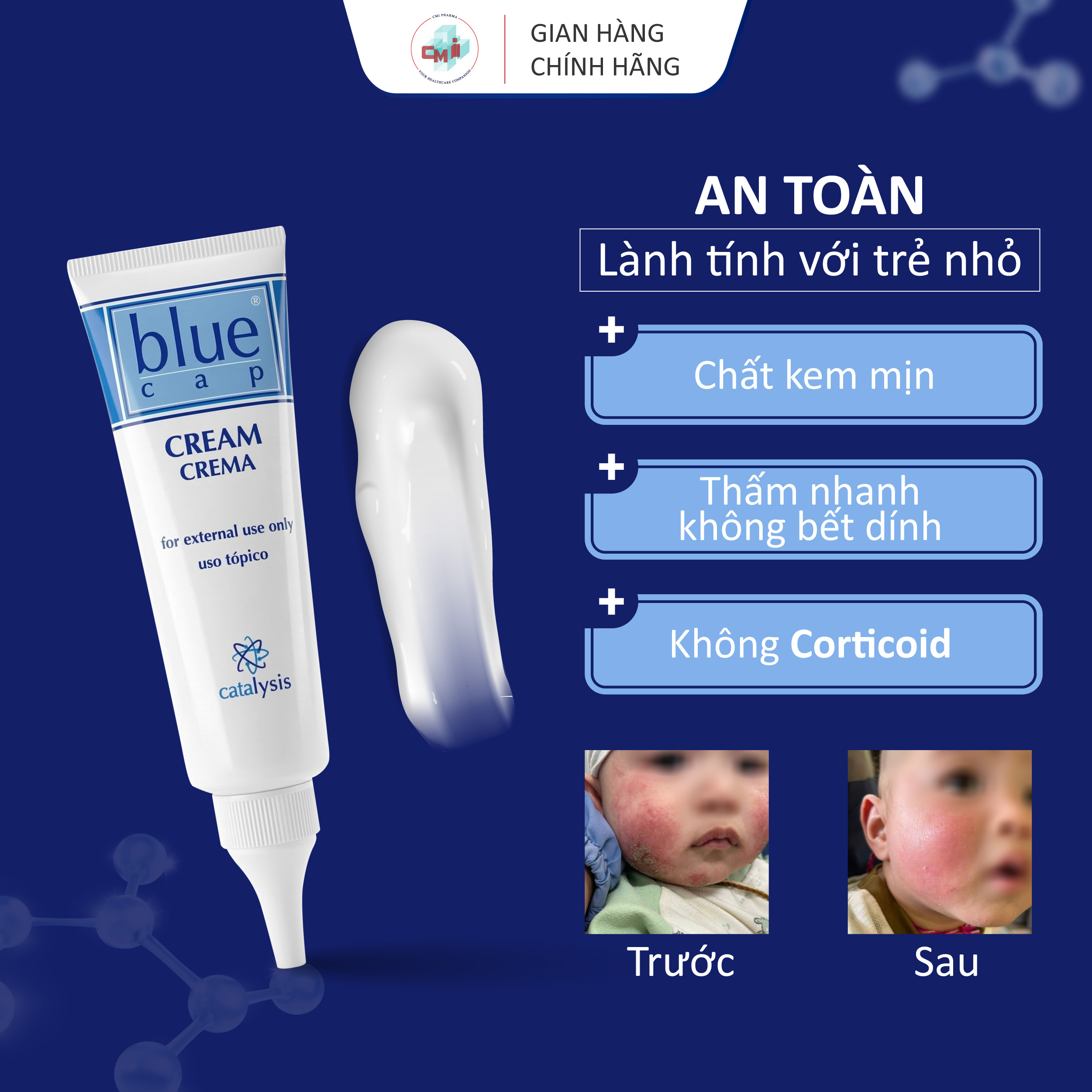 Kem Bôi Blue Cap Cream 50g, Dùng Cho Viêm Da Cơ Địa, Viêm Da Dị Ứng ...