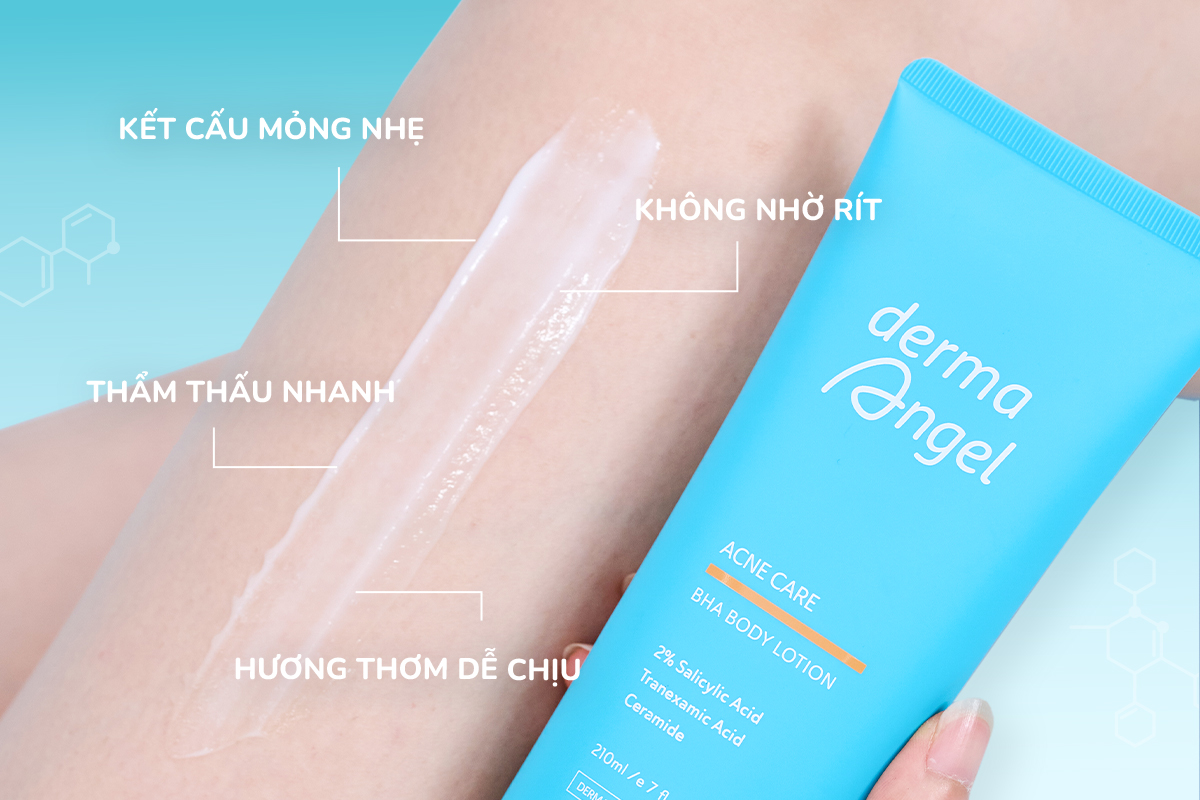 Kem Dưỡng Thể Giảm Mụn Dưỡng Da Mềm Mịn Derma Angel Acne Care Bha Body ...