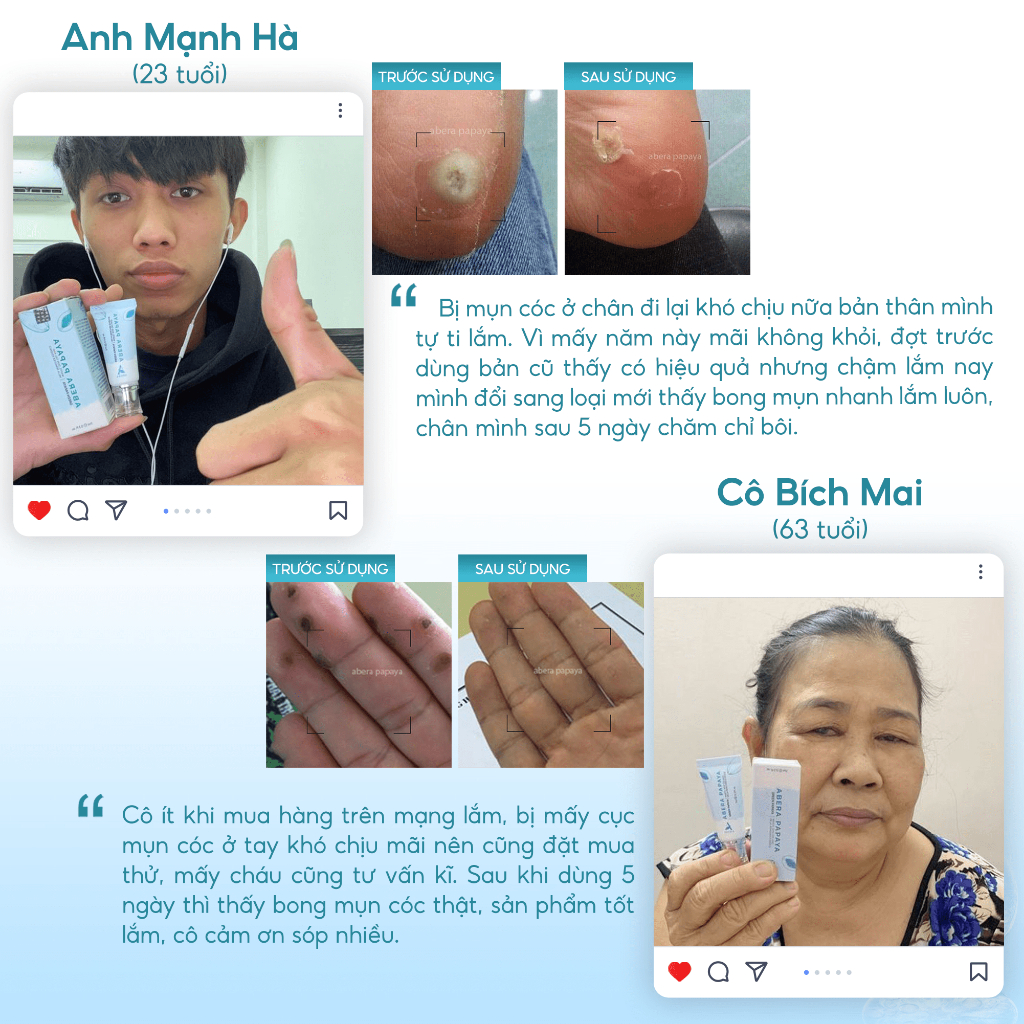 Tinh chất đu đủ Abera Papaya & Kem liền sẹo Abera Scar - Ngăn ngừa sẹo ...